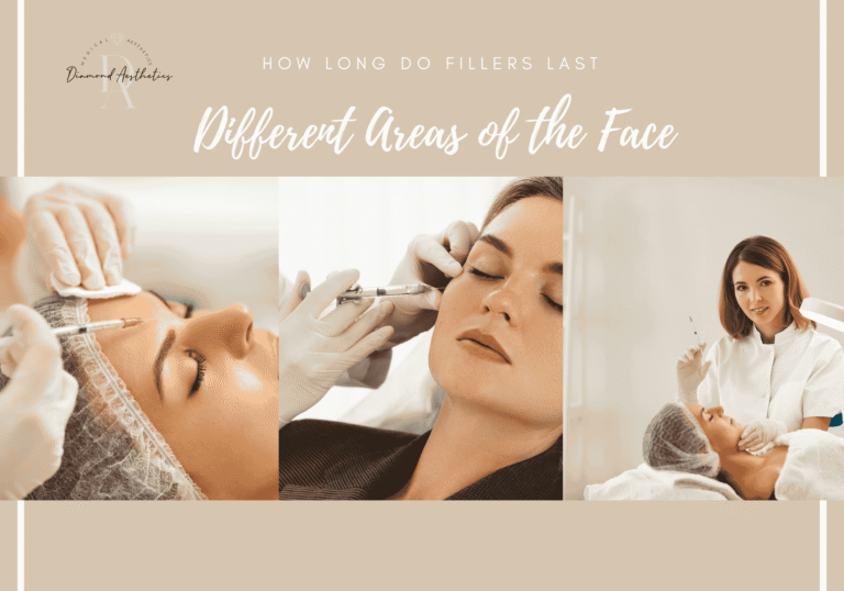 How Long Do Dermal Fillers Take to Settle? Timeline, Tips, and Longevity